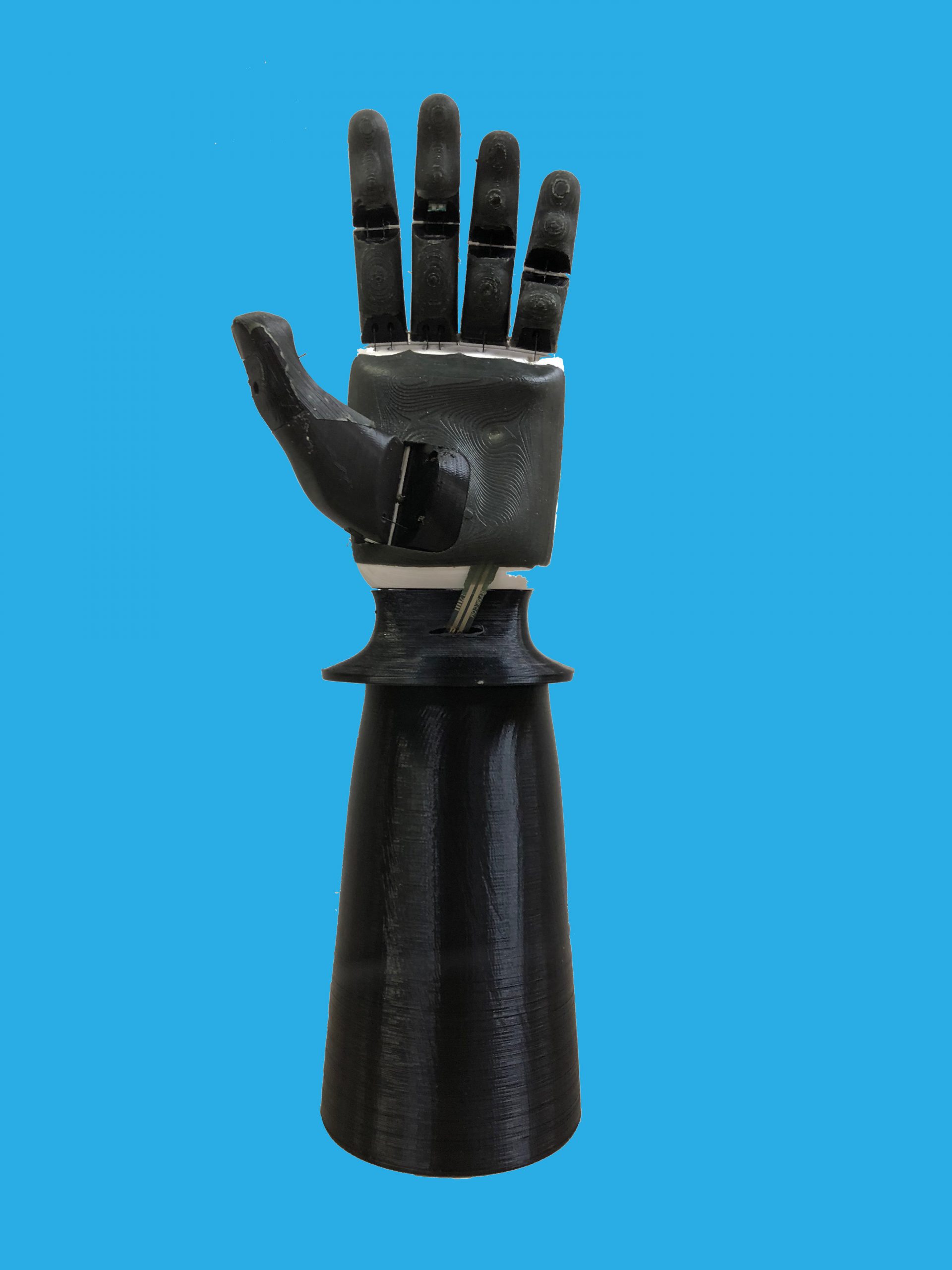 Alt-Bionics | Affordable Prostheses